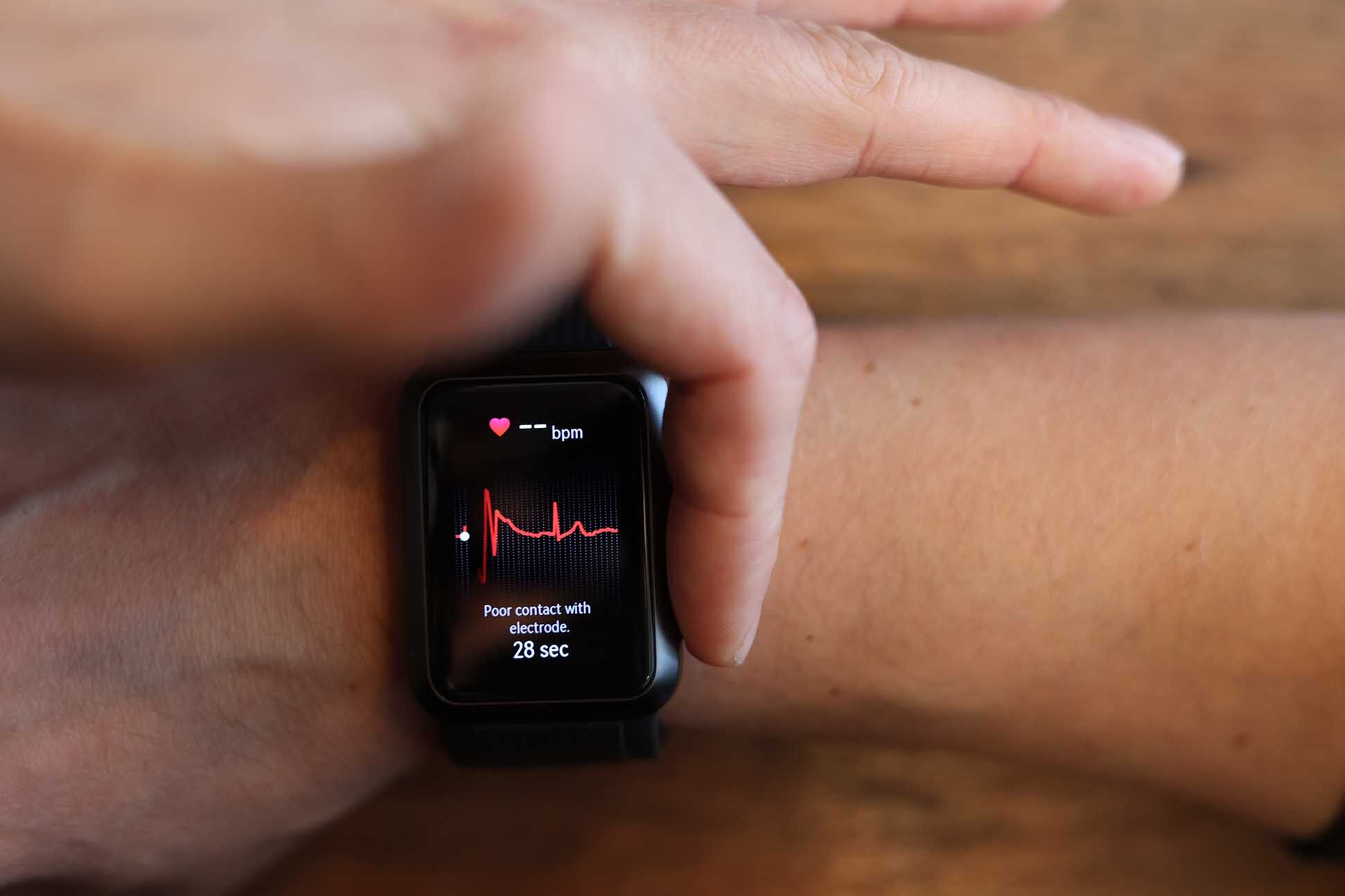 Unsere 5 Smartwatch mit EKG und Blutdruckmessung Testsieger