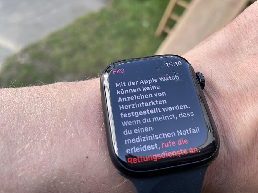 Unsere 5 Smartwatch mit EKG und Blutdruckmessung Testsieger